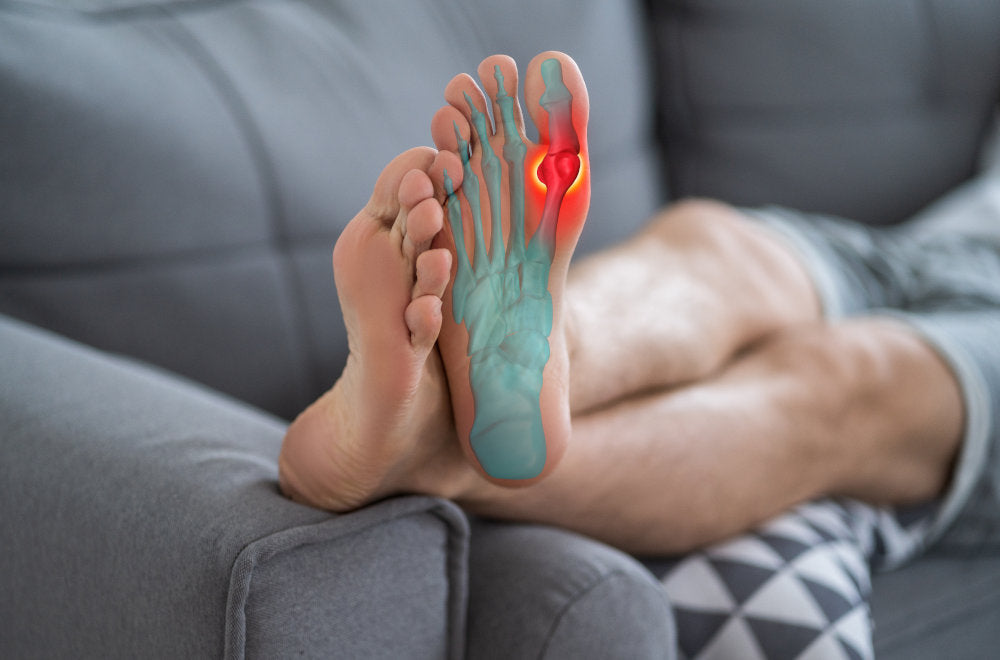 Understanding Bunion Toe Treatment and Causes – Serene Living Co