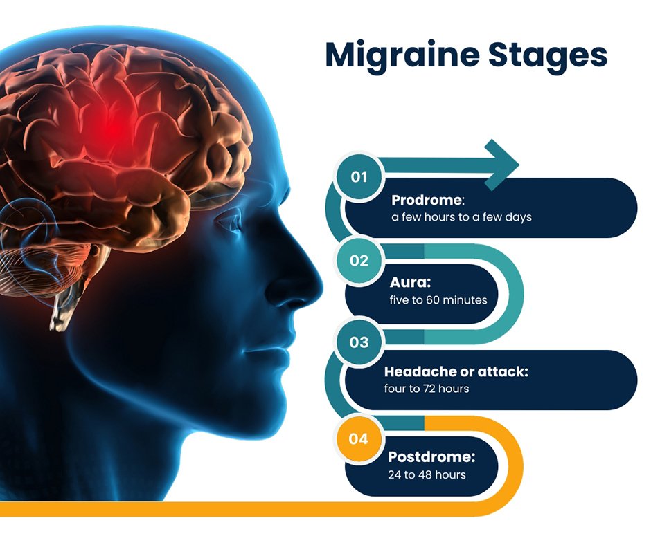 Understanding Chronic Migraine: Causes, Symptoms, and Effective Treatm ...